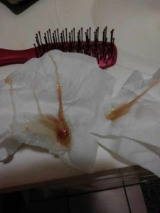 Mucus Plug FAQs for First Time Moms